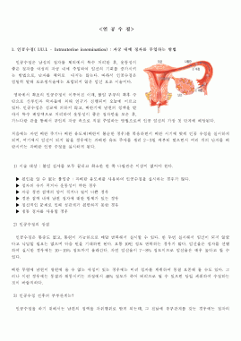 인공수정 자궁 불임-1페이지