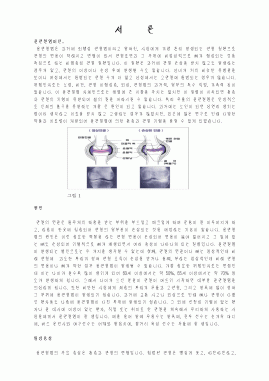 골관절염 문헌고찰-1페이지