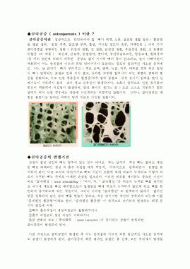 골다공증 ( osteoporosis )-1페이지