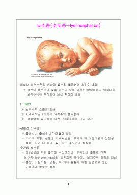 뇌수종(수두증-Hydrocephalus)-1페이지