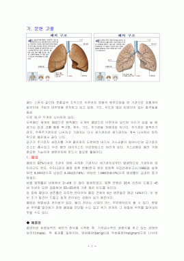 [논문] 폐암 케이스 -1페이지