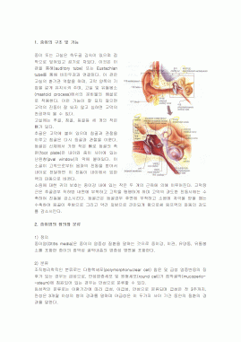 중이염-컨퍼런스 자료-1페이지