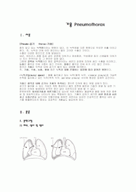 Case study - 기흉에 대한 Case study [CS]-1페이지