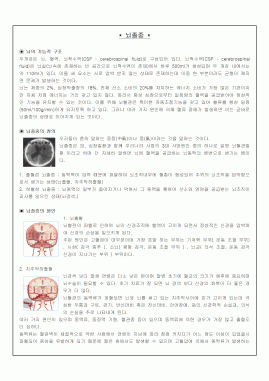 뇌졸중 (stroke)과 심근경색증 (myocardial infarction) -1페이지