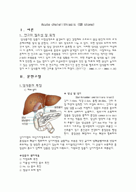 담석증(GB stone) 환자의 Case study-1페이지