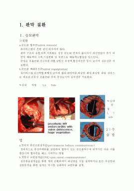 [논문] 판막질환-1페이지