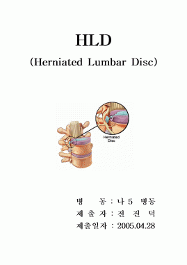 HLD(herniated lumbar disc)-1페이지