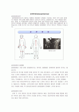 골관절염 간호진단 사례-1페이지