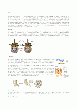 디스크-추간판 탈출증-1페이지