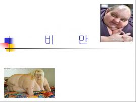 비만의 사회적인 관점 및 양.한방의 비만 치료법-1페이지