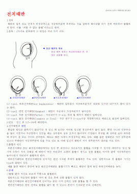 전치태반과 태반조기박리-1페이지