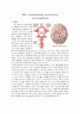 VBI 척추기저동맥부전-1페이지