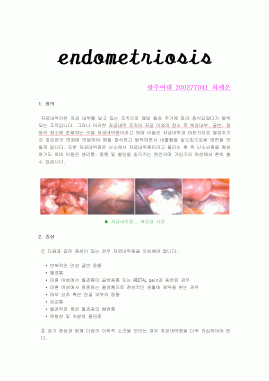endometriosis-1페이지