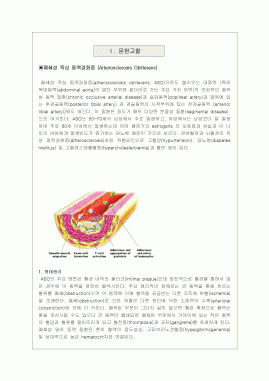 폐쇄성 죽상 동맥경화증 (Arteriosclerosis Obliterans) 케이스-1페이지