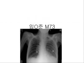 흉막삼출증의 임상례와 서양의학 한의학적 고찰 및 치료-1페이지