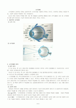 시각장애 [의약학]-1페이지