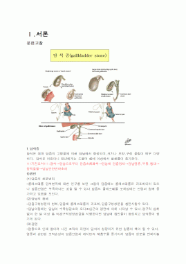 담석증,총담관석증(GB,CBD stone)-1페이지