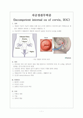 자궁경관무력증-1페이지