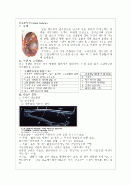 난소종양(Ovarian tumors)-1페이지