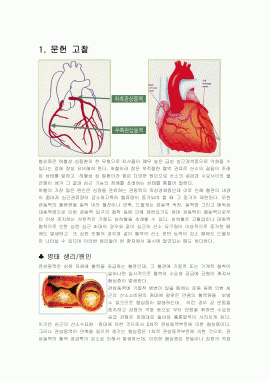 협심증 문헌고찰 및 사례연구-1페이지