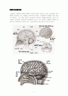 뇌졸중에 관하여-1페이지