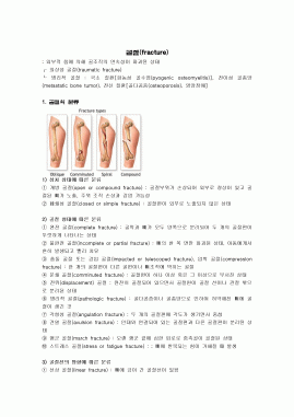 골절(fracture)-1페이지