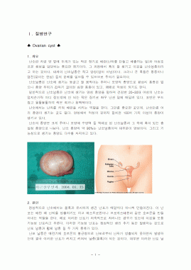 난소낭종 (문헌고찰, 간호과정, 각종검사)-1페이지