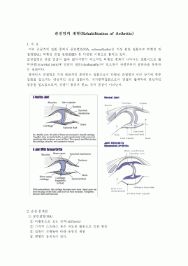 관절염의 재활-1페이지