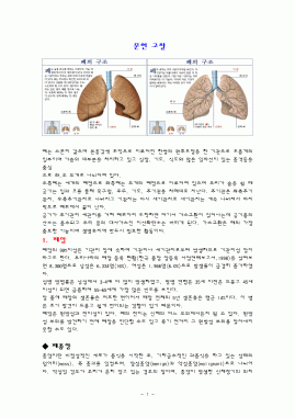 수술실케이스-폐암-1페이지