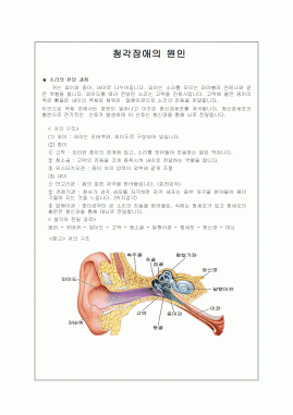 청각장애의 원인-1페이지