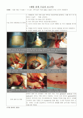 제왕절개 수술실 보고서-1페이지