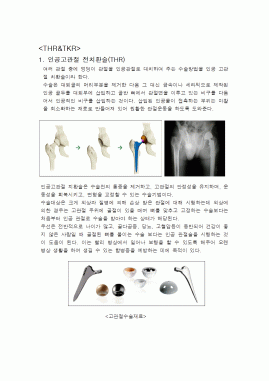 인공고관절 전치환술, 인공슬관절 치환술에 대한 문헌고찰과 수술전후간호, 수술후 운동에 관하여-1페이지