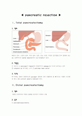 췌장질환별 수술방법및 적응증, 장, 단점-1페이지