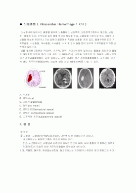 뇌내출혈 [논문] -1페이지