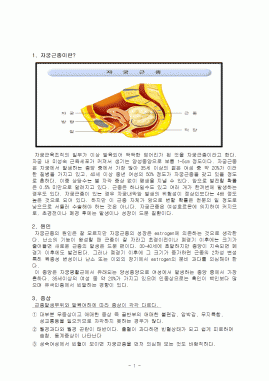 자궁근종 모성질환 자궁 근종-1페이지