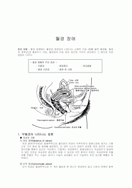 월경장애와 간호-1페이지