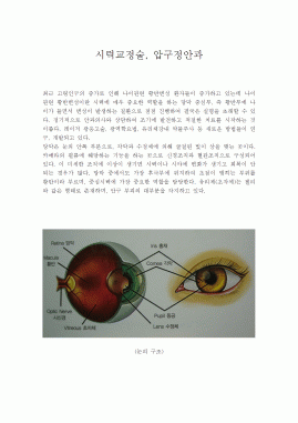 시력교정술, 압구정안과(빛간섭단층촬영)-1페이지