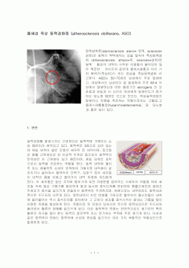 폐쇄성 동맥경화증-1페이지