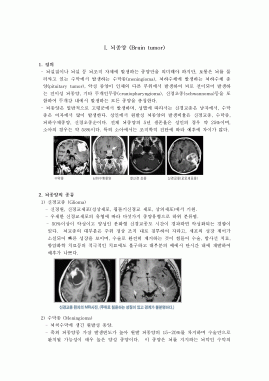 뇌종양(Brain tuomr)-1페이지