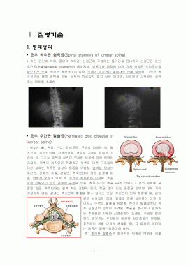 요추 척추관 협착증(Spinal stenosis of lumbar spine)case study-1페이지