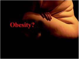 Obesity(비만)에 대한 조사-1페이지