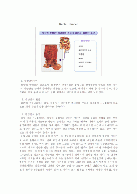 직장암[Rectal Cancer]정보-1페이지