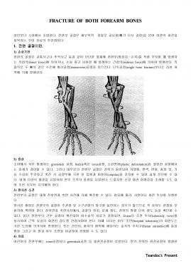 [물리치료] FRACTURE OF BOTH FOREARM BONES[전완 골절]-1페이지