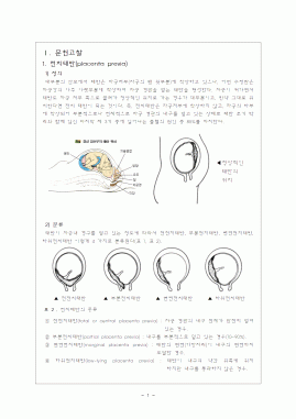 전치태반으로 인한 제왕절개수술-1페이지