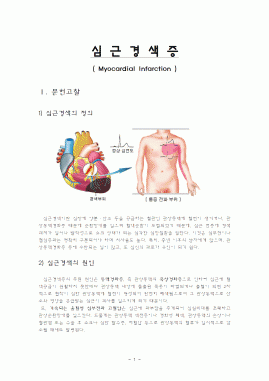 심근경색 환자의 간호사례연구-1페이지