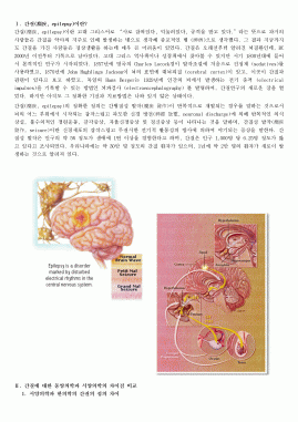 [한방] 간질에 대한 동서의학 비교-1페이지