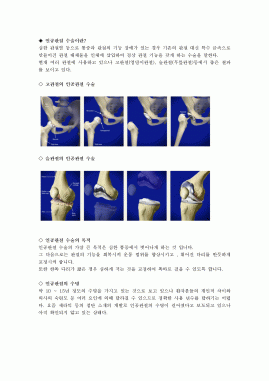 인공 슬관절, 고관절 수술-1페이지