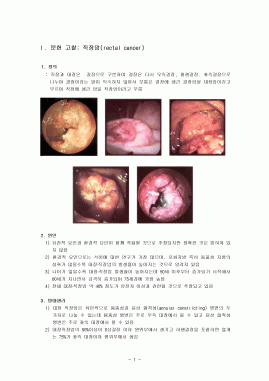 직장암(rectal cancer) 문헌고찰-1페이지