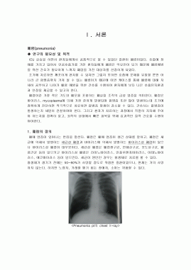 폐렴케이스 [논문] -1페이지