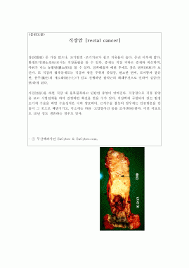 <문헌고찰>직장암 [rectal cancer]+교육자료까지 전부포함-1페이지